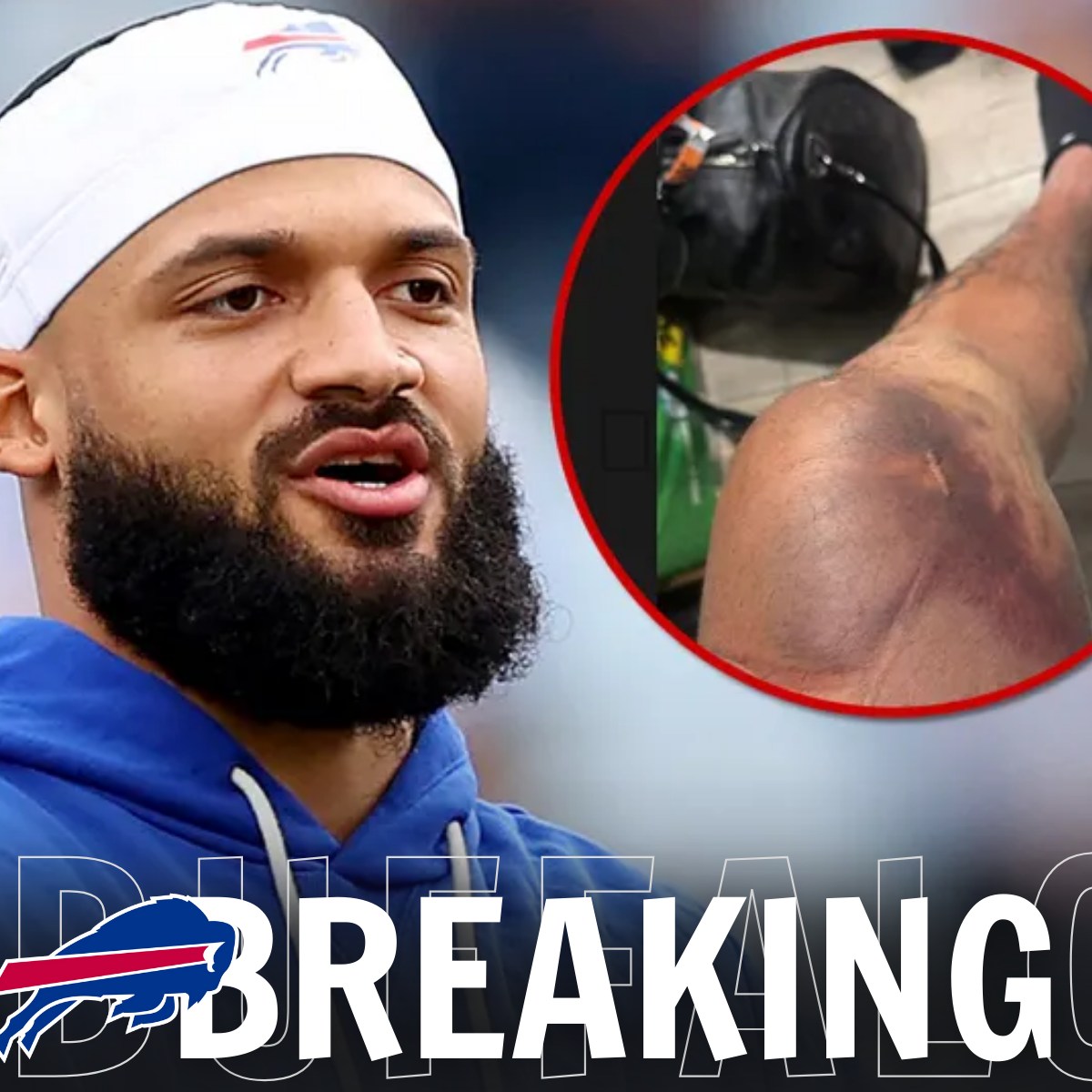 THE DARKEST DAY IN NFL HISTORY! Buffalo Bills Lose Player For Rest of ...